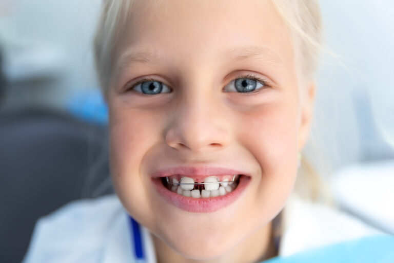 What Causes a Gap in Your Front Teeth? - Gentle Teeth & Braces